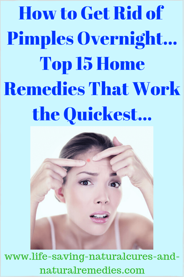 15 Natural Home Remedies for Acne That Work Like a Charm!